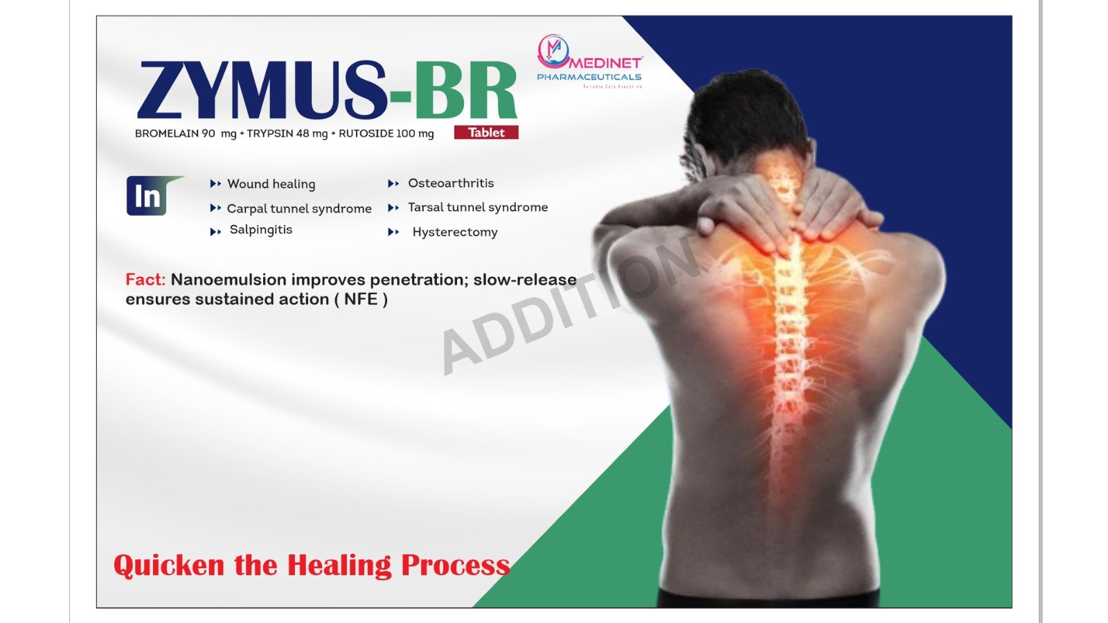 Trypsin + Bromelin+ Rutoside - Medinetpharma